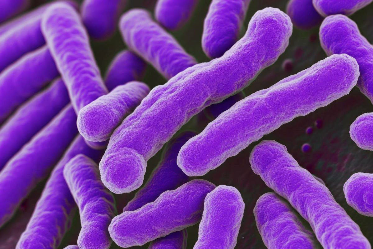 Grave infección intrahospitalaria en niños por Klebsiella oxytoca en ...